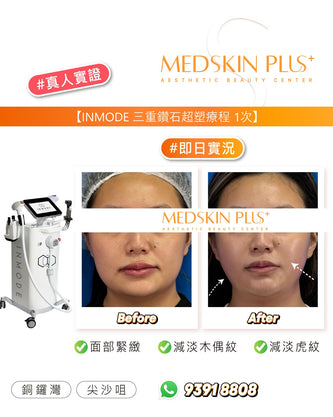 以色列 INMODE 煥肌緊緻：360°全方位回春，重塑緊緻V面 – Medskin Plus